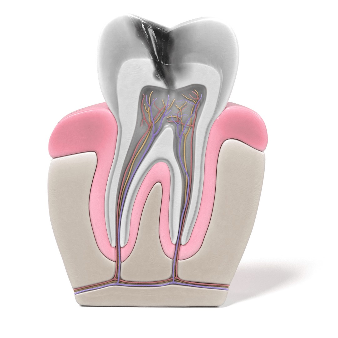 What Is a Root Canal? | Kilby Family and Cosmetic Dentistry